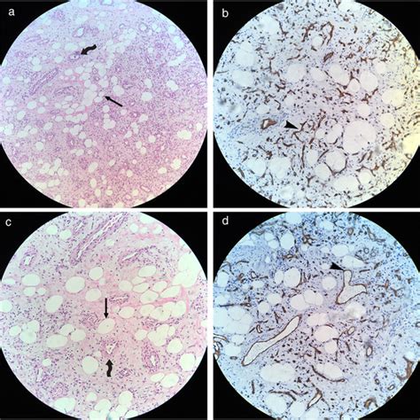 Photomicrograph Of The Pathological Specimens Of The Presented Cases