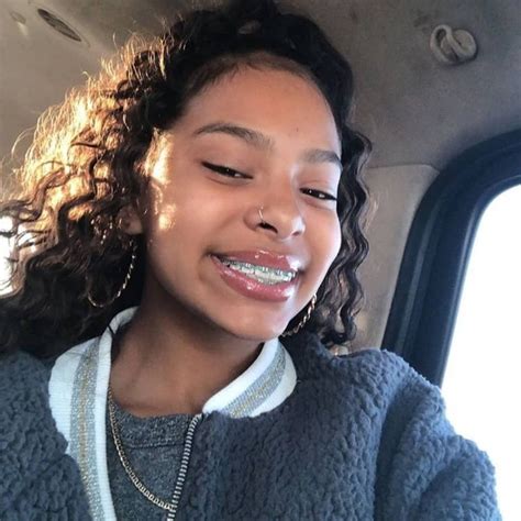 Instagram Post By Tamera • Jul 30 2020 At 1014pm Utc Cute Girls With Braces Light Skin