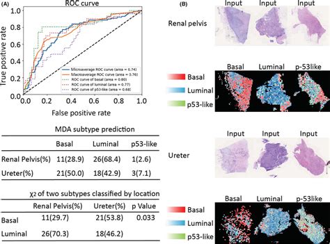 Performance Of Validation Cohort A Receiver Operating Characteristic