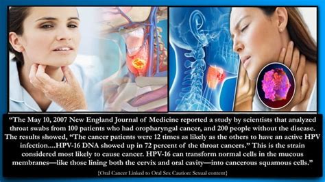 7 The Lgbt Movement Health Issues Oral Sex Dangers Ppt