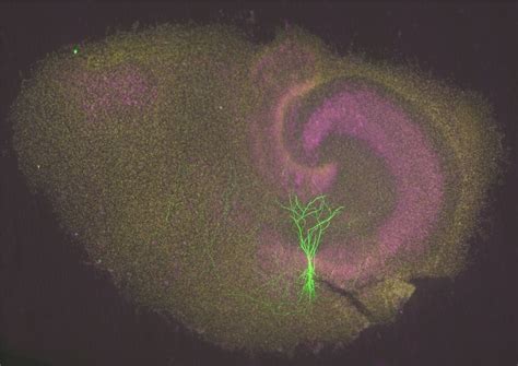 Interdisciplinary Institute For Neuroscience On Linkedin Thursdaypicture Neun Dapi Gfp Fiji