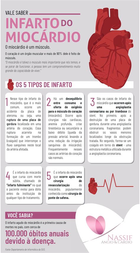 Infarto Agudo Do MiocÁrdio Dra Nassif
