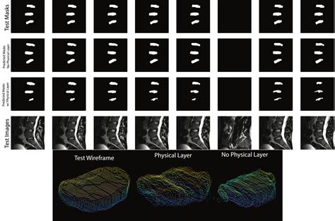 Automated Segmentation And 3d Surface Model Generation Of Intervertebral Discs From Mr Images