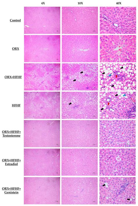 Genistein And Sex Hormone Supplementation Modulated Hepatic Pparα δ