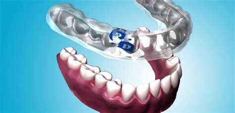 Portland Perio Protect Say Goodbye To Gum Disease