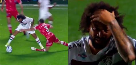 La Impactante Lesión De Jugador Argentino Tras Falta De Marcelo