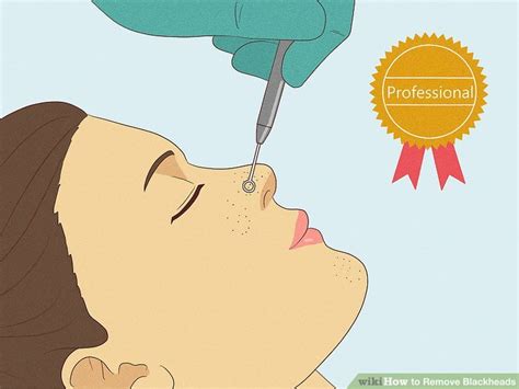 Ways To Remove Blackheads WikiHow