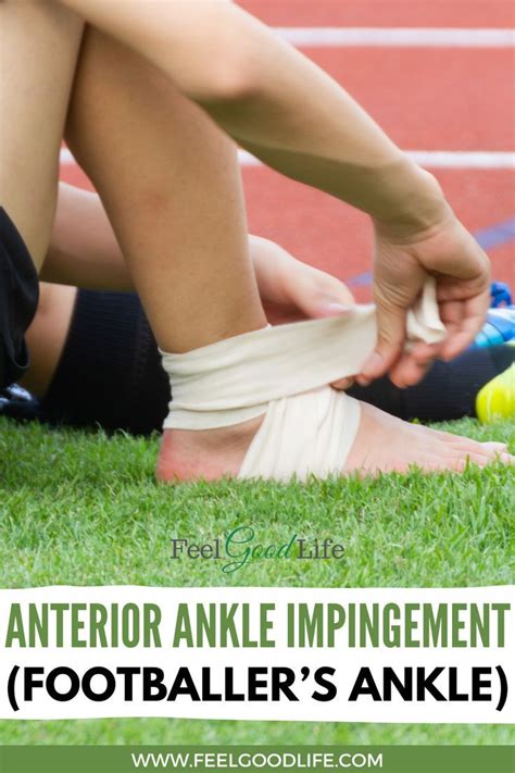 Anterior Ankle Impingement In Athletes Causes Symptoms And Prevention