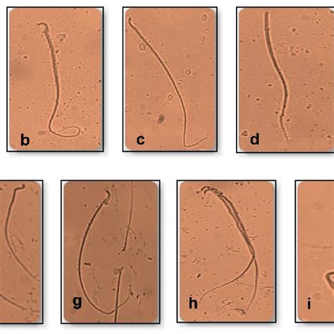The Sprague Dawley Rats Sperm Morphology Ie Normal And Abnormal Download Scientific Diagram