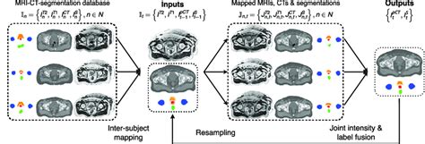 Joint Segmentation And Ct Synthesis At Iteration T All The Atlases Are