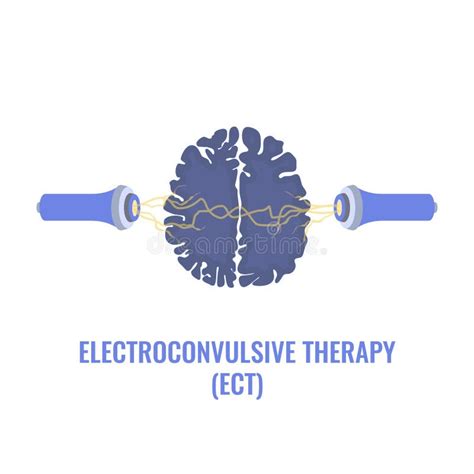 Electroconvulsive Therapy Stock Illustrations 47 Electroconvulsive