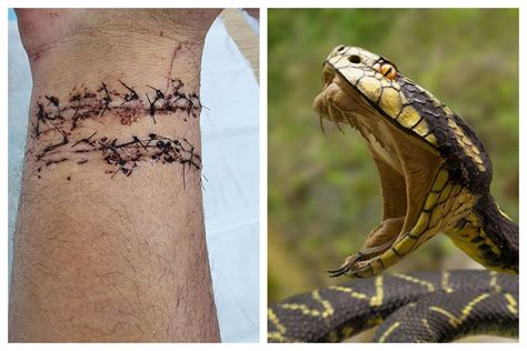 Python Severs Mans Artery With Bite Beyond Imagined Capabilities