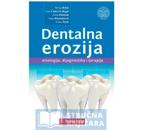 Dentalna Erozija Etiologija Dijagnostika I Terapija Hrvoje Brkić Stručna Knjižara Srbija