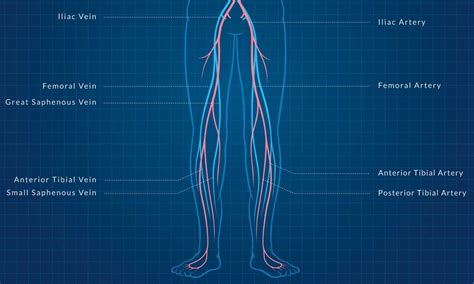Get A Leg Up On Lower Extremity Revascularization Coding Aapc Knowledge Center