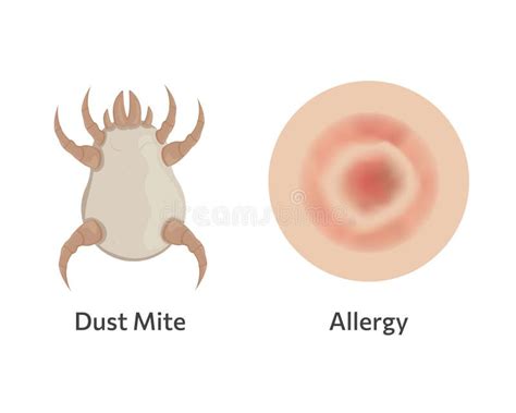 Dust Mites And Parasites Insecticide Vector Illustration Design Stock
