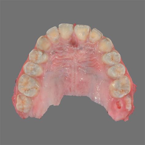Archivo STL Gratis MAXILAR SUPERIOR A Partir De Escaneado Intraoral