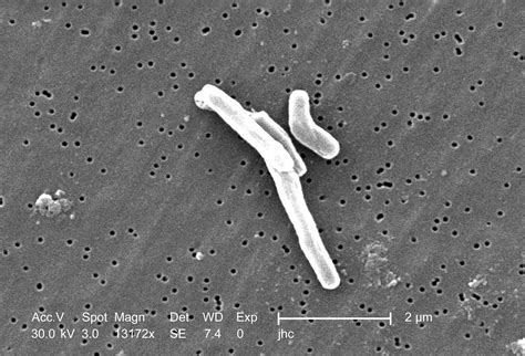 Free Picture Enlarged Ralstonia Mannitolilytica Bacteria Harvested