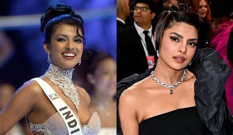 Priyanka Chopra Reveals A Botched Nose Surgery Sent Her Into A Deep
