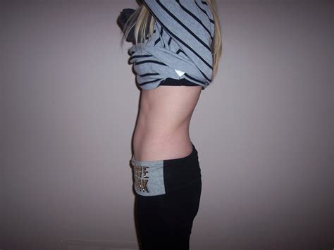 Some Crazy Before And After Pics And Awesome Results Of Closing The Diastasis Recti With The