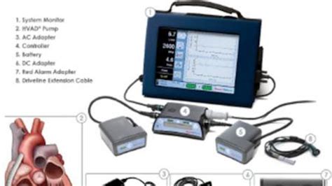 Fda Class I Recall Heartware Hvad Battery Cables Data Cables Adapter Cables And Controller 2
