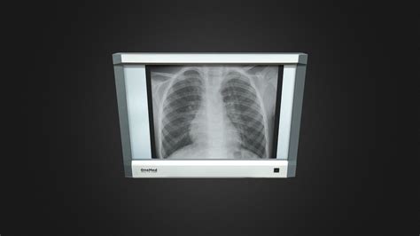 XRAY Viewer - 3D model by aruvana [b5b05b2] - Sketchfab