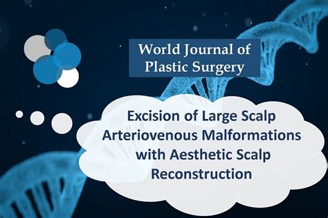 Excision Of Large Scalp Arteriovenous Malformations With Aesthetic Scalp Reconstruction