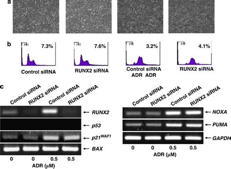 Runt Related Transcription Factor 2 Runx2 Inhibits P53 Dependent
