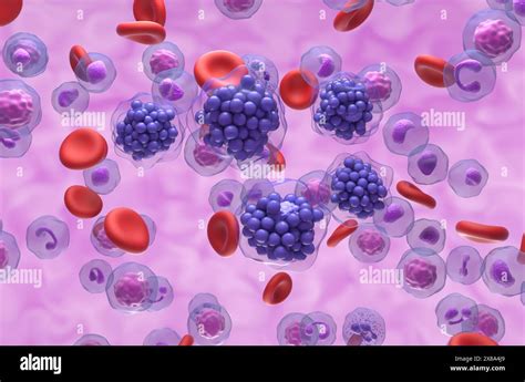 Diffuse Large B Cell Lymphoma DLBCL Isometric View D Illustration Stock Photo Alamy