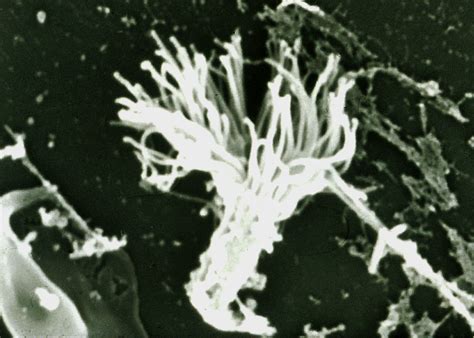 Histopathology Of The Uterine Cervix Digital Atlas