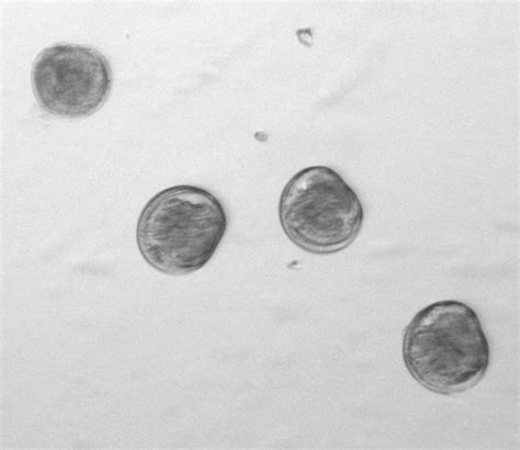A Ostrea Edulis Larvae Cultivated At A Ph Of 847 For 20 Days The