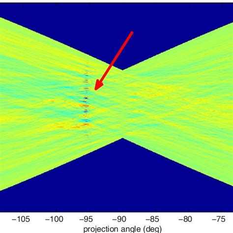 Qflow Mri Segmentation Procedure The User Draws A Contour On Phase 1