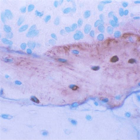 Gene Structure Of Mouse Dspp Download Scientific Diagram