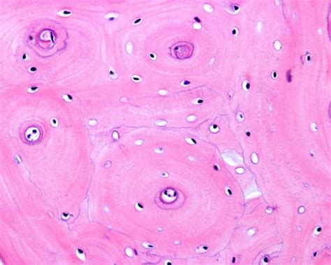 Chaptec On Linkedin Decalcification Bonehistology