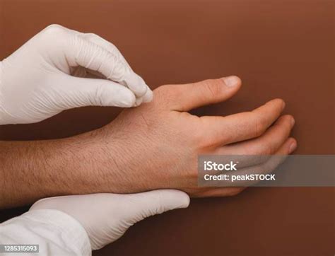 침술은 환자의 손에 침술 바늘을 삽입합니다 많은 질병에 대한 침술 치료 갈색 배경에 닫기 가리키기에 대한 스톡 사진 및 기타