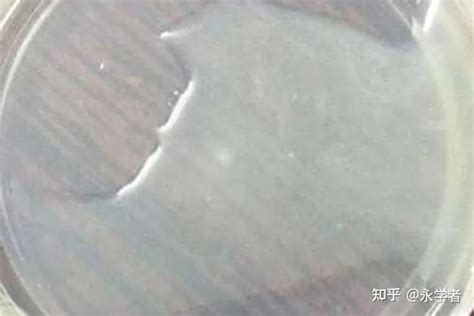 精液正常一般是什么颜色的什么才是正常标准 知乎