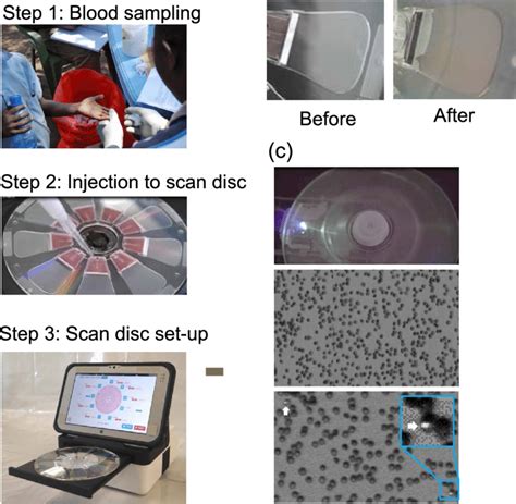 Process For Malaria Diagnosis Using The Automated Malaria Diagnostic