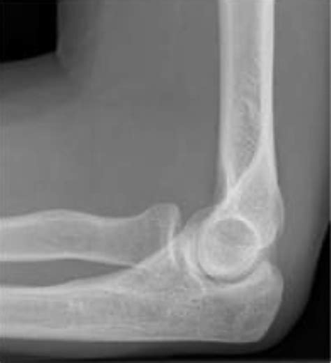 Lab 4 Radiology 2 Diagram Quizlet