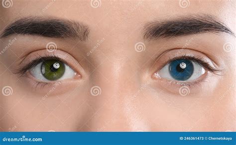 Woman With Different Colors Of Eyes Closeup Heterochromia Iridis Stock Image Image Of Iridum