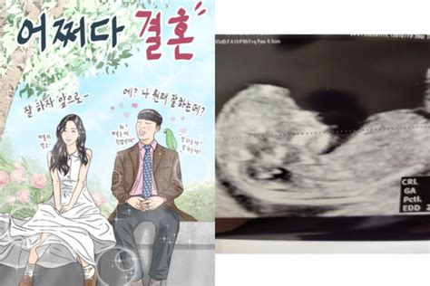 장윤석 혼전임신→오늘 4일 미모의 치기공사 예비신부와 결혼[종합] 네이트 뉴스