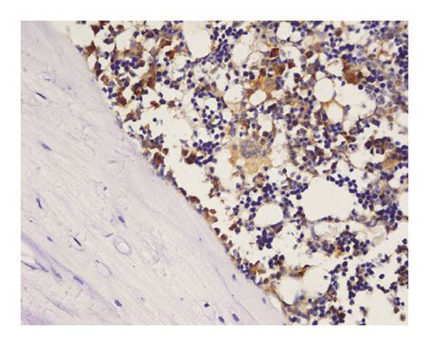Effects Of Simvastatin On The Autophagic Regulation In Hc Rats The