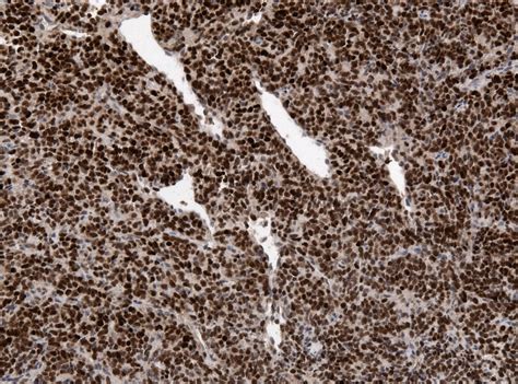 Case 106 Libre Pathology