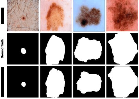 Segmentation Results Of The Proposed Method On Isic 2018 The