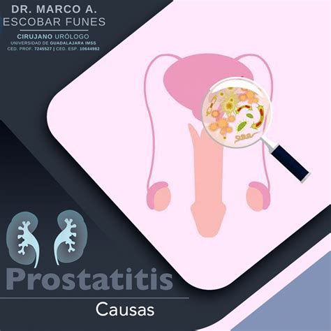 Causas La Prostatitis Bacteriana Aguda Es Provocada Generalmente Por Cepas Comunes De Bacterias