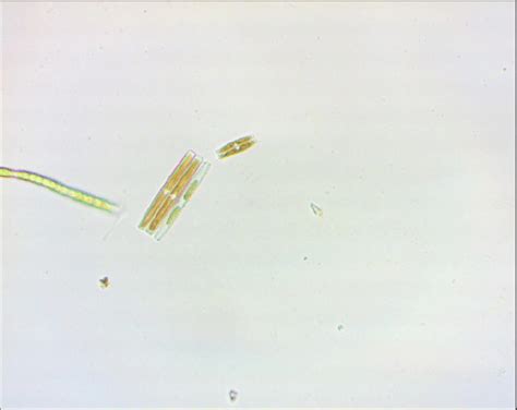 Bacillariophyceae Diatoms Under Microscope [phot Tomasz Garbowski