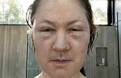 얼굴 터질 것 같았다회춘에 수십억 쓴 美억만장자에 무슨일이 매일경제