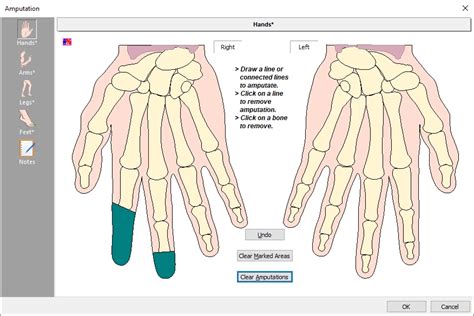 Upper Extremity Evaluation Software Biometrics Ltd E Link