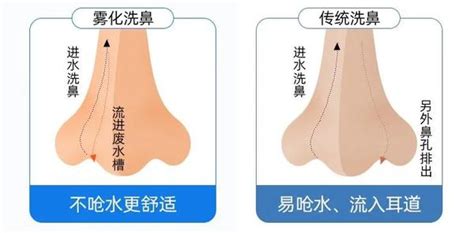 鼻子不舒服快来学学怎么洗鼻子 知乎