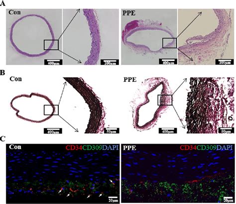 Histological Sections Of Abdominal Aorta A Hematoxylin And Eosin Download Scientific Diagram