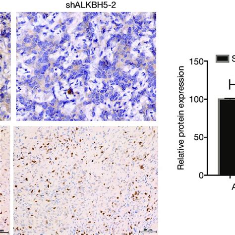 Alkbh5 Regulated Aurkb Expression In Rcc Cells And Correlated With