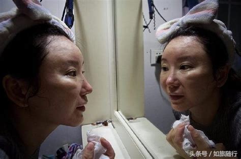 中國女孩為了變美去國外黑診所整容，結果付出慘痛代價！ 每日頭條